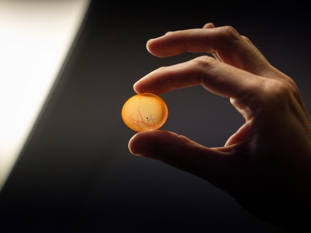 Sensory Implants are Helping to Return Lost Vision and Hearing | Discovery